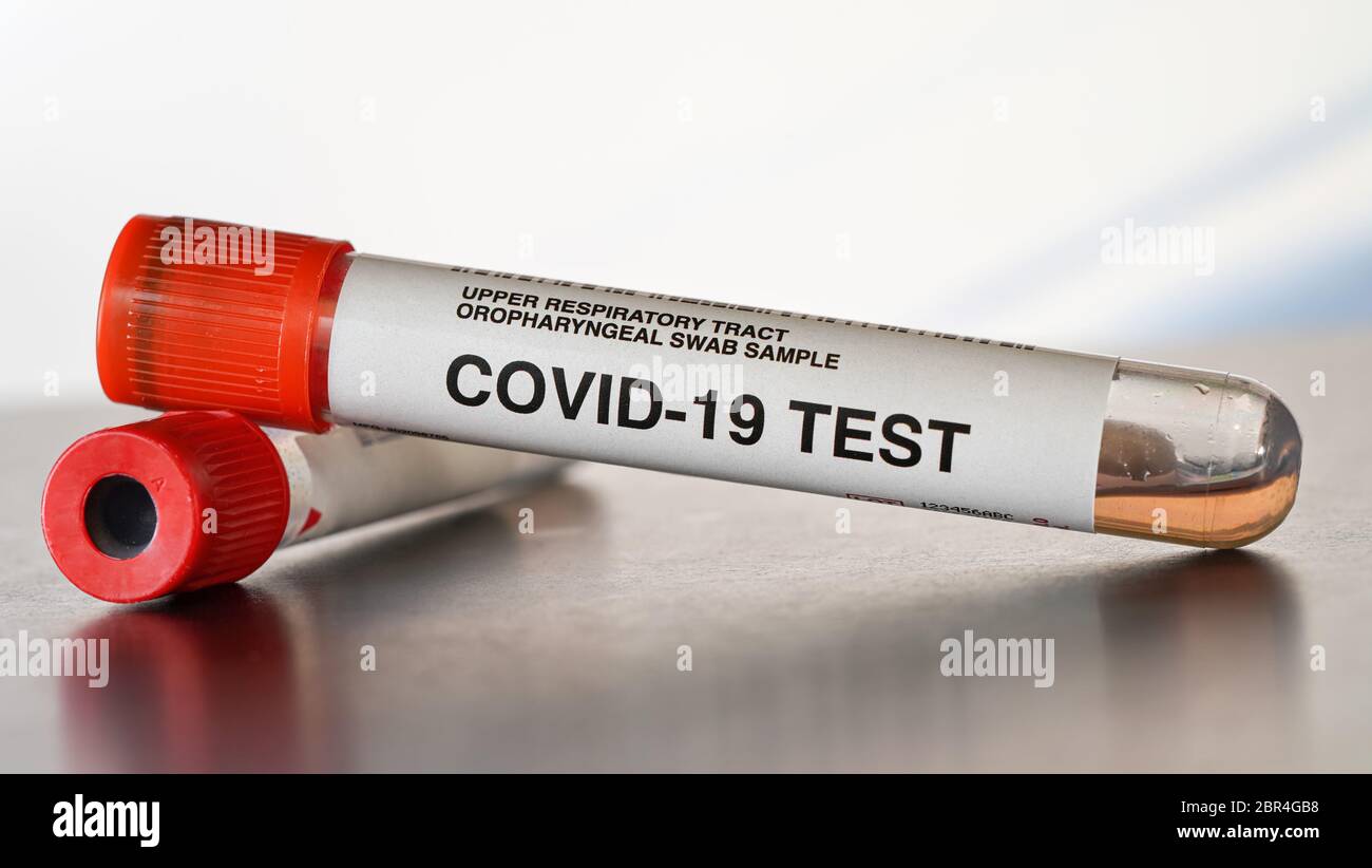 Coronavirus test concept - vial sample tube with cotton swab, another ...