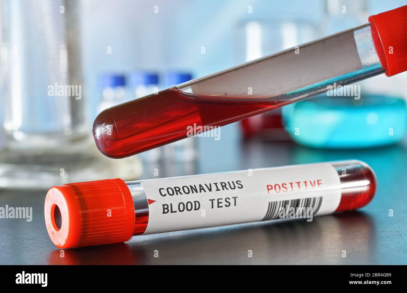 Blood vial barcode hi-res stock photography and images - Alamy
