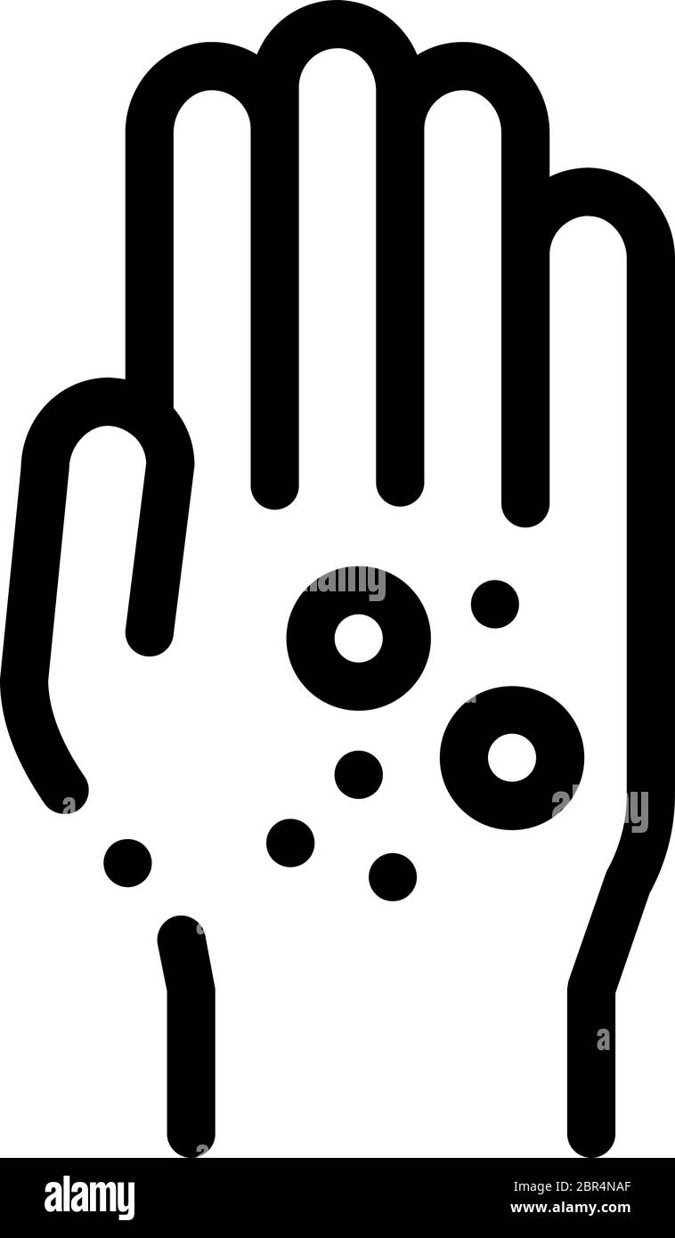 dermatitis rash on hands icon vector outline illustration Stock Vector ...