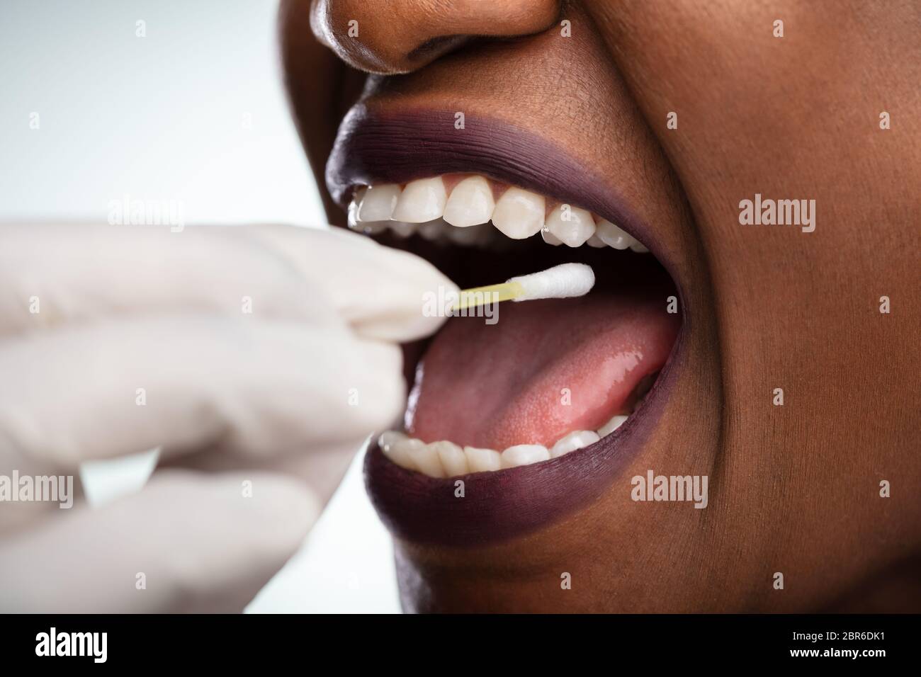 Skin Swab Test High Resolution Stock Photography and Images - Alamy