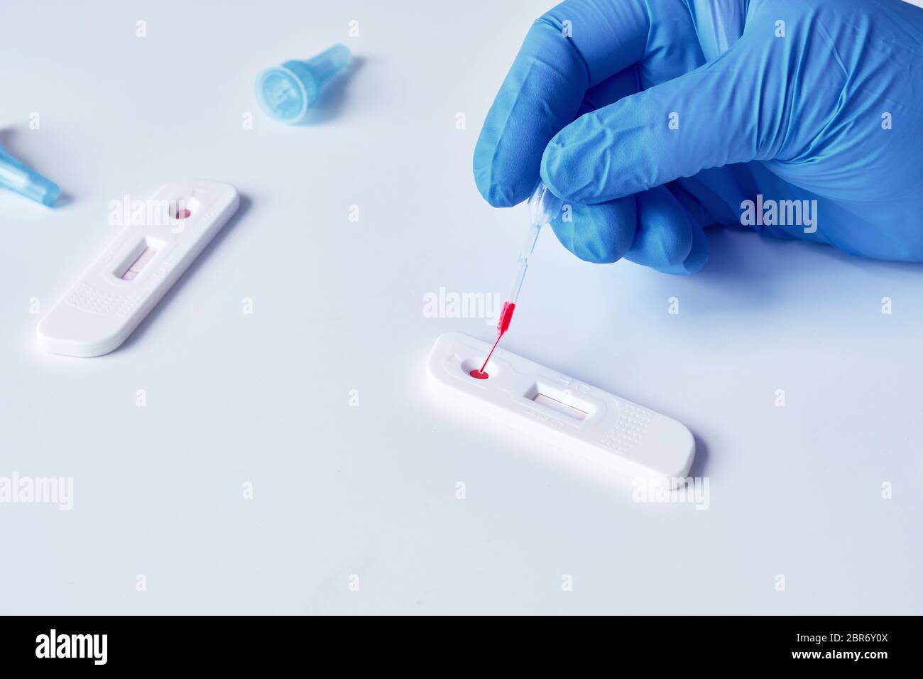 Rapid COVID-19 test for detection of specific antibodies IgM and IgG to ...