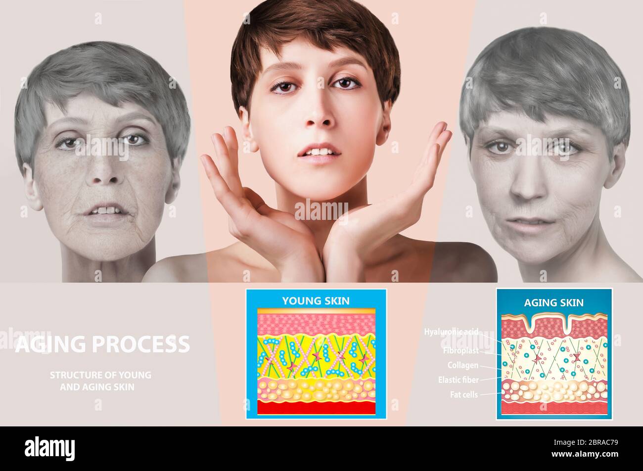 The younger skin and aging skin. elastin and collagen. A diagram of ...