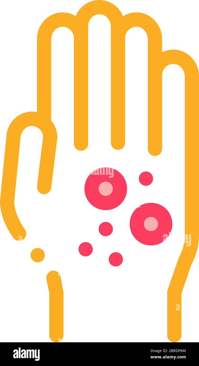 dermatitis rash on hands icon vector outline illustration Stock Vector ...