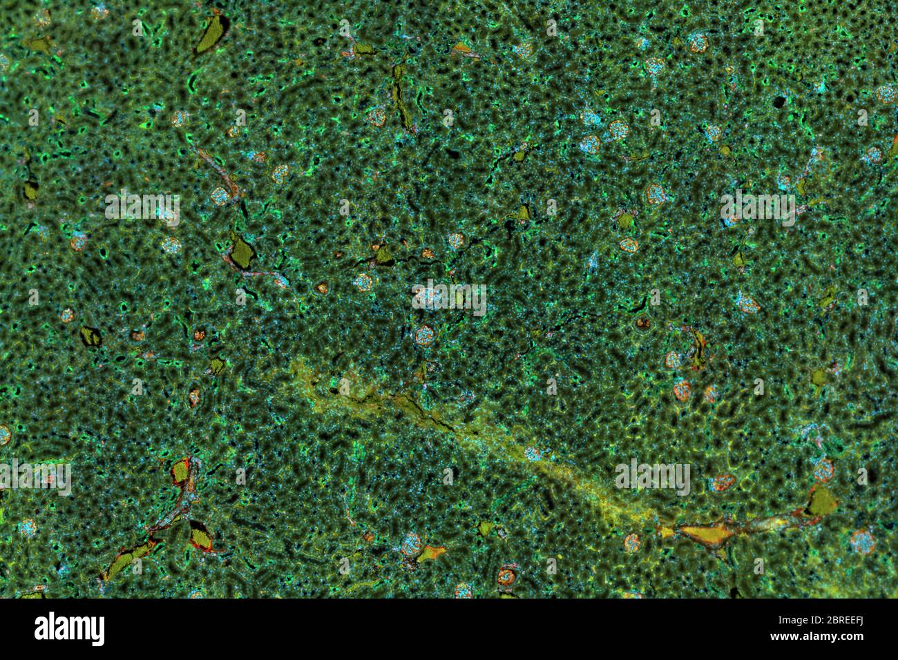 Mouse brain tissue hi-res stock photography and images - Alamy