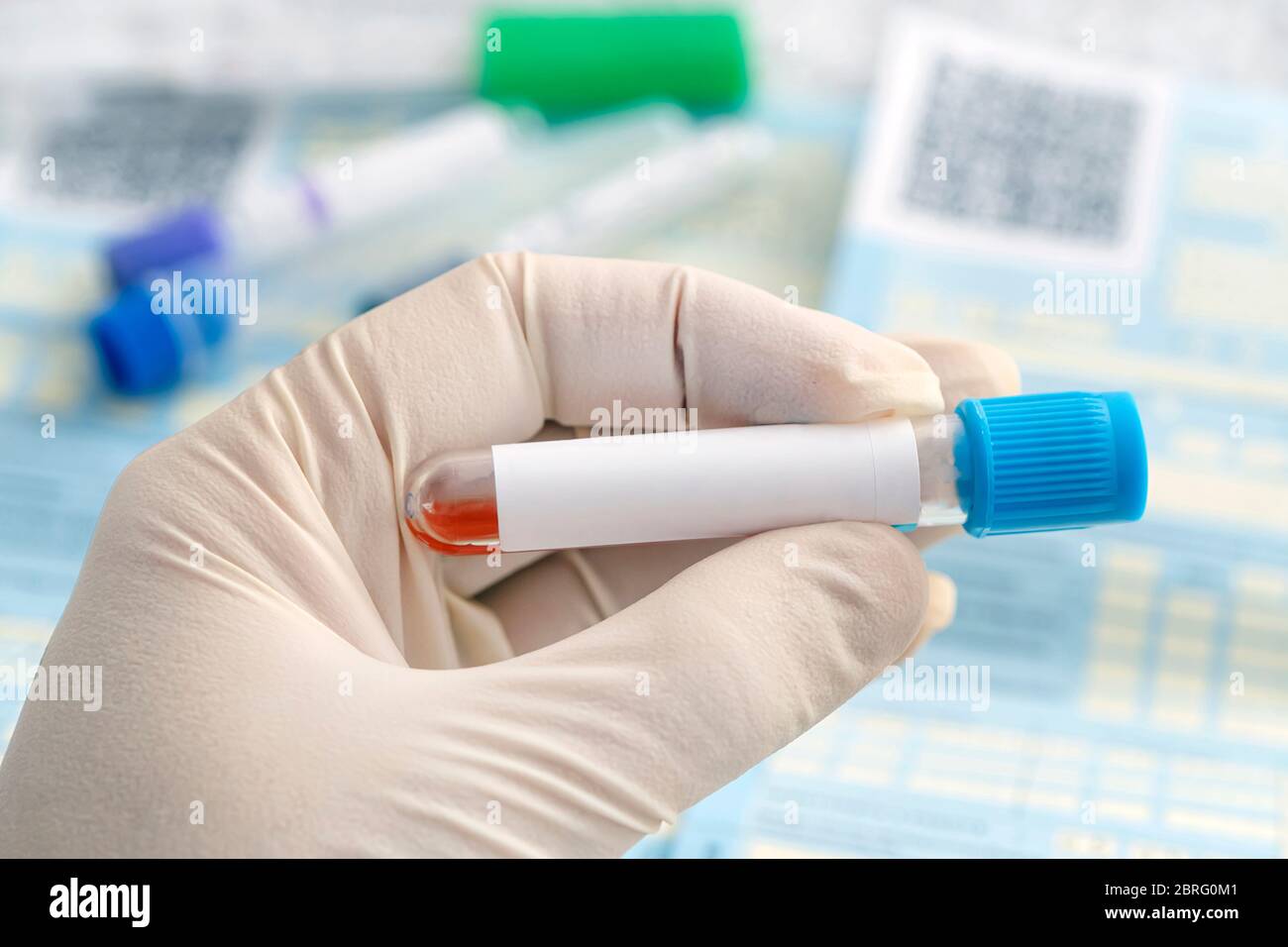 Blood sample label hi-res stock photography and images - Alamy