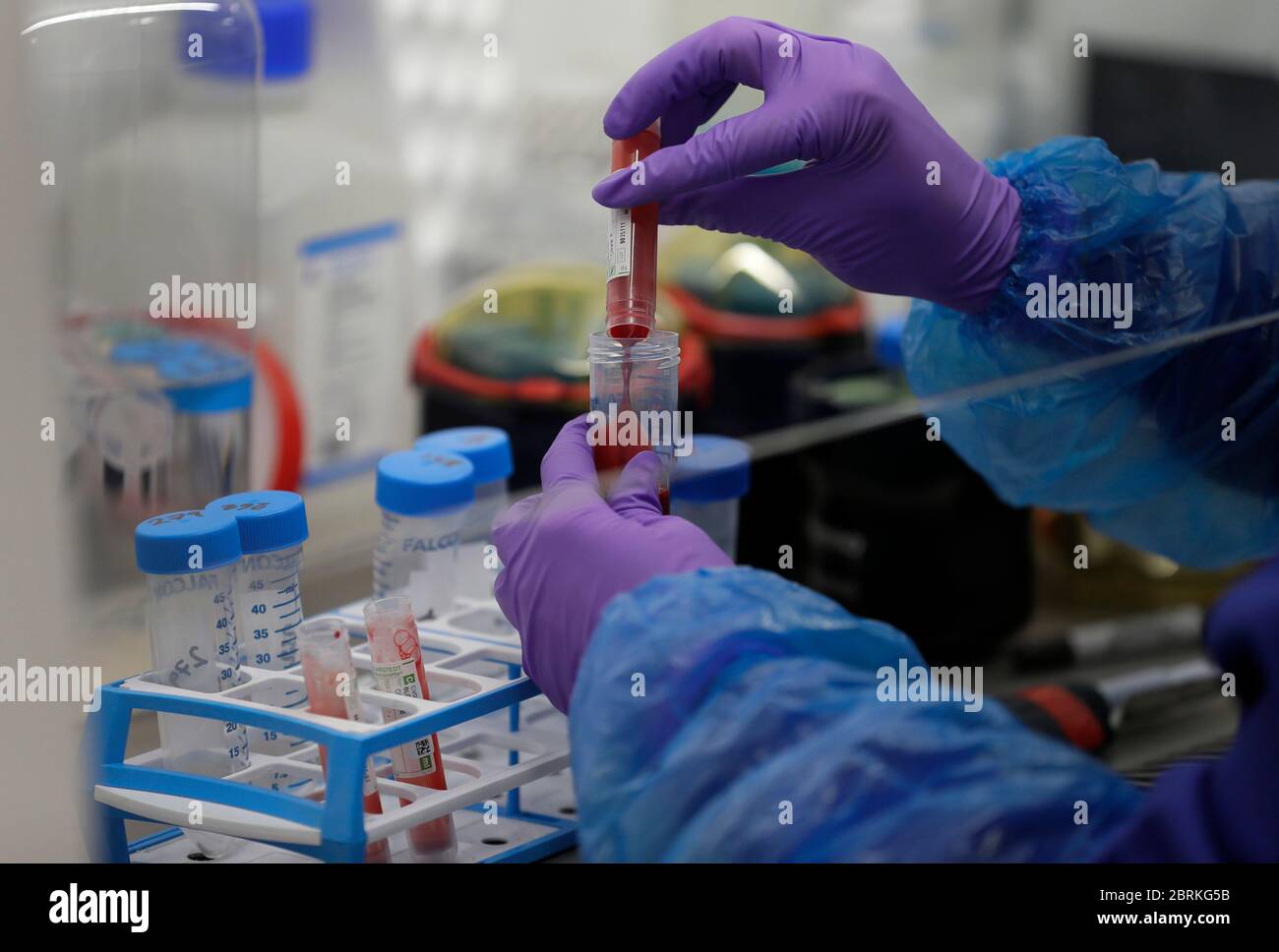 Blood analysis samples hi-res stock photography and images - Alamy