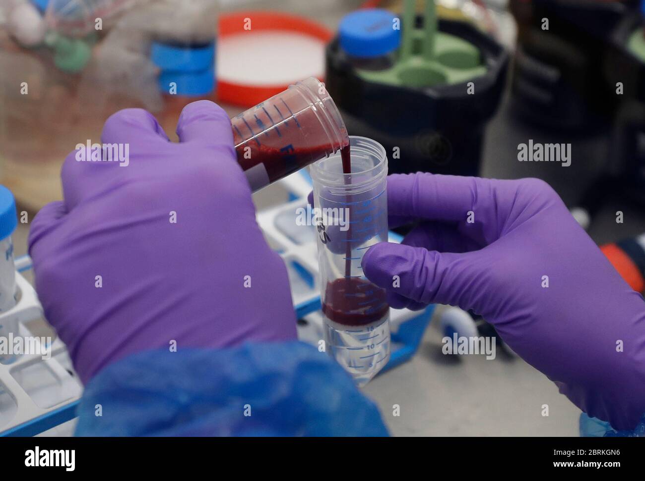Blood analysis samples hi-res stock photography and images - Alamy