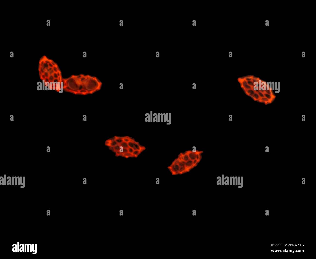 Aleuria aurantia (orange peel fungus) spores, inverted bright field ...