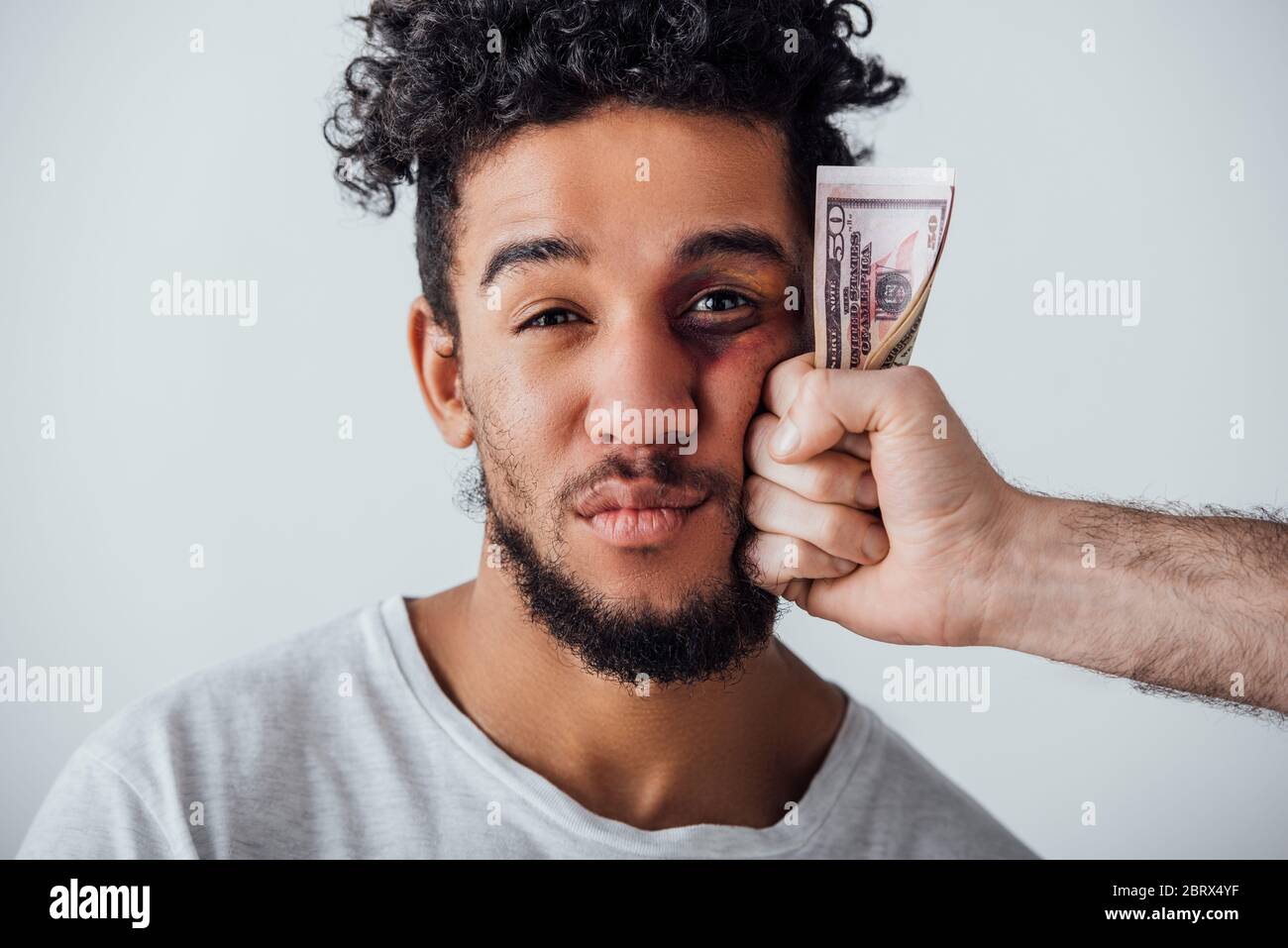 Camera male bruise studio hi-res stock photography and images - Alamy