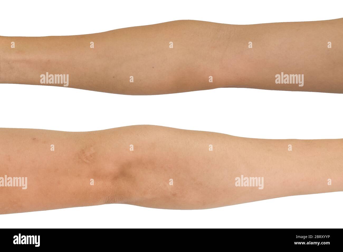 Front and back arms isolated on white background. with clipping path ...