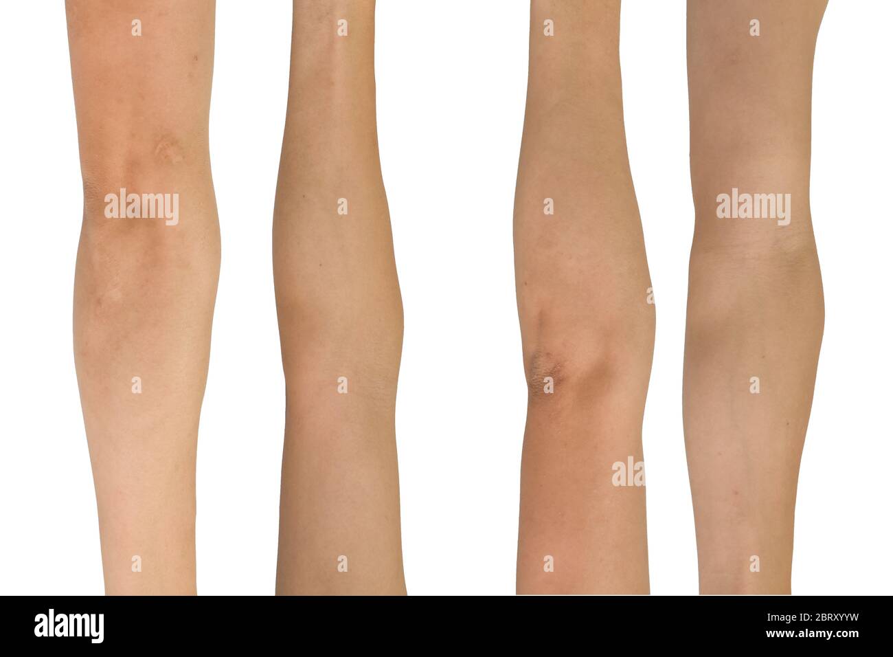 Front and back arms isolated on white background. with clipping path ...