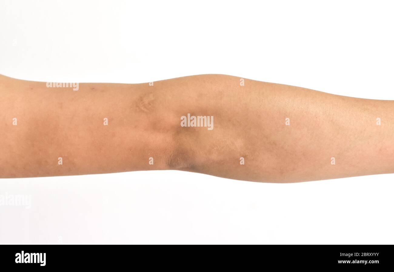 Arms isolated on white background Stock Photo - Alamy