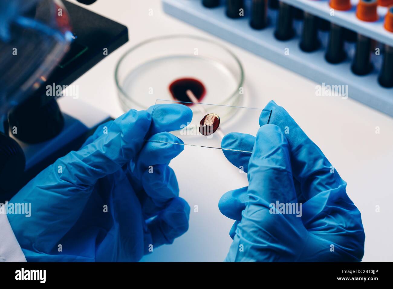 Hands of a laboratory worker doing blood test Stock Photo - Alamy