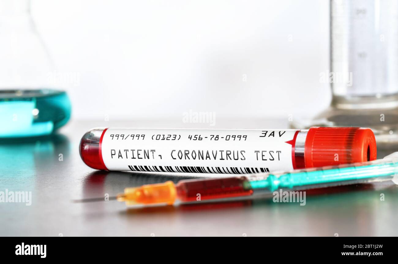 Sample vial with blood, label (own design, dummy data) coronavirus test ...