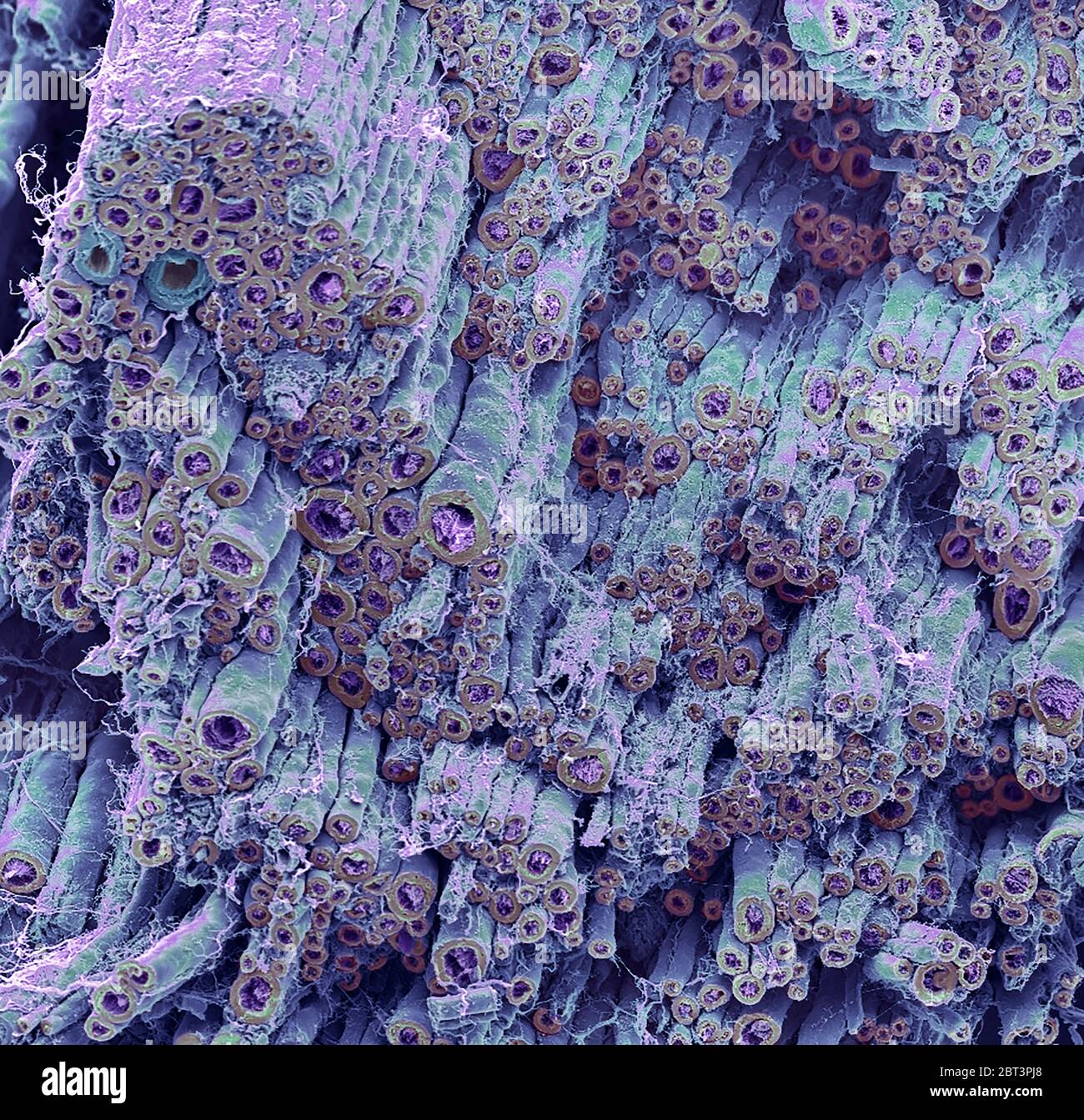 Nerve. Coloured scanning electron micrograph (SEM) of a freeze-fracture ...