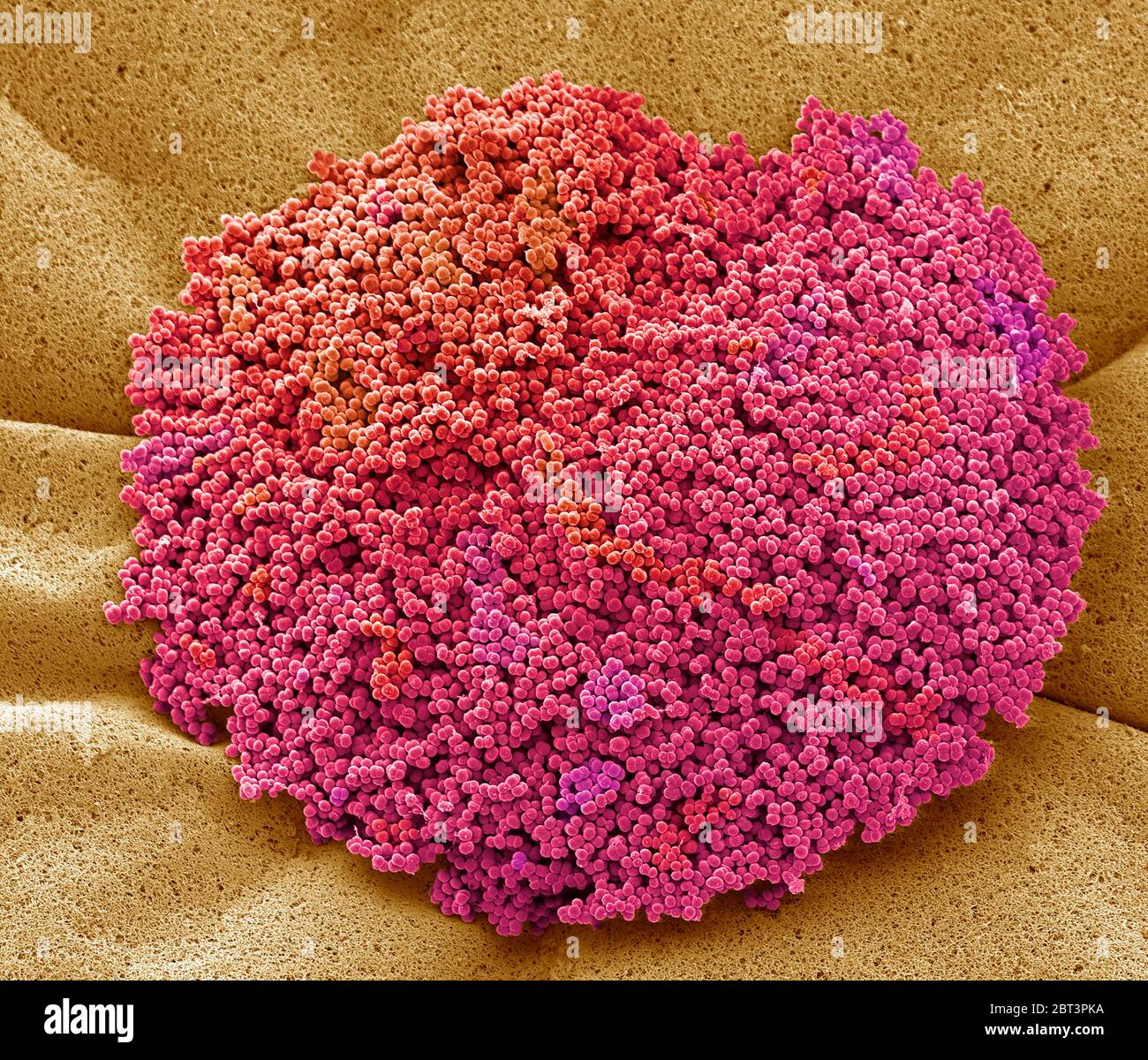 Human skin microscope hi-res stock photography and images - Alamy