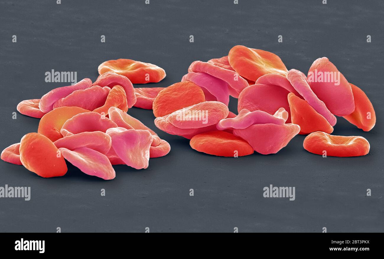 Red blood cells. Coloured scanning electron micrograph (SEM) of red ...