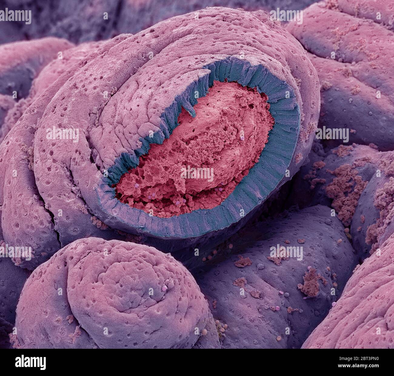 Small intestine. Coloured scanning electron micrograph (SEM) of a ...