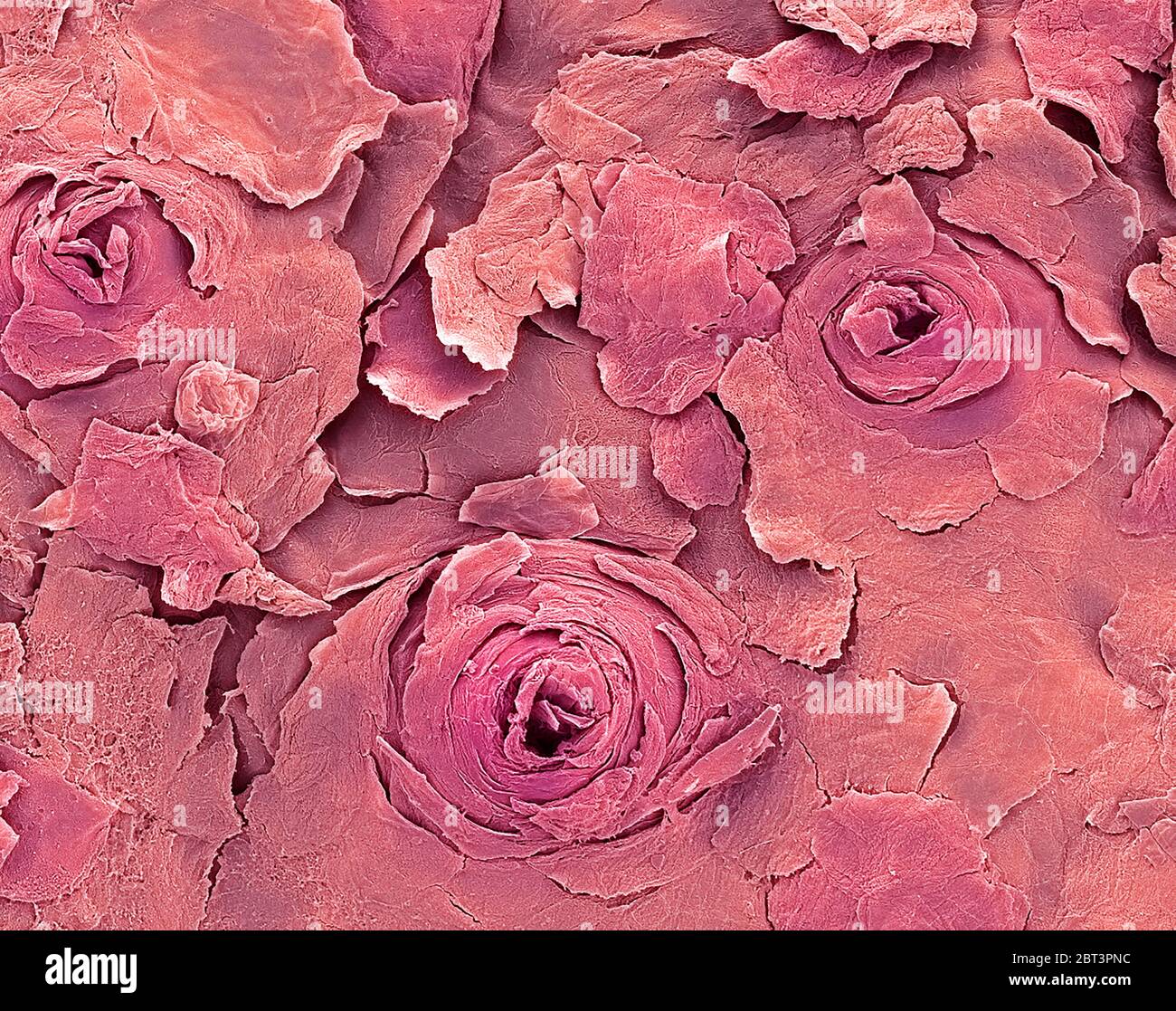 Human skin cells micrograph hi-res stock photography and images - Alamy