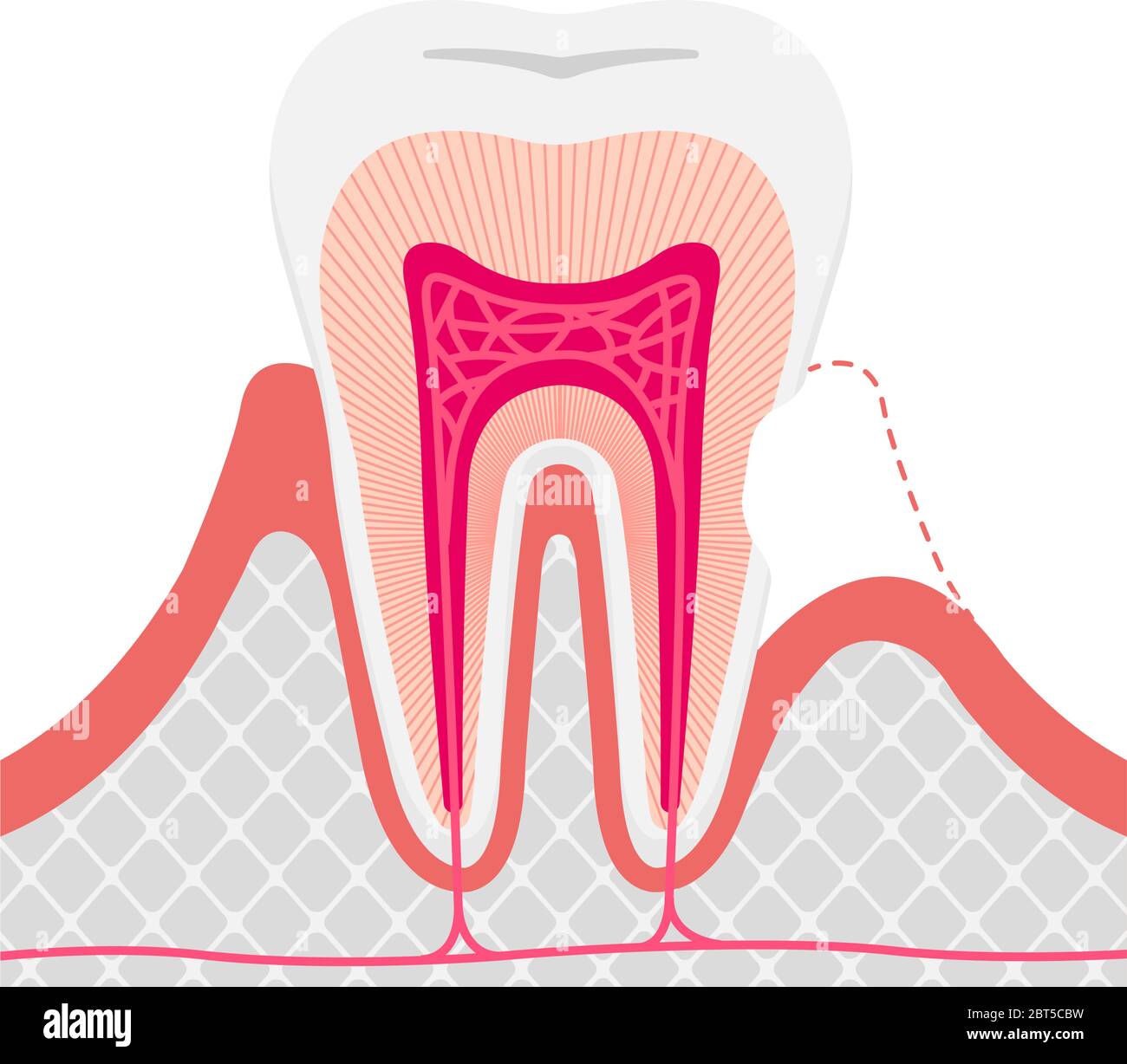 Cause and mechanism of Sensitive teeth vector illustration / no text ...