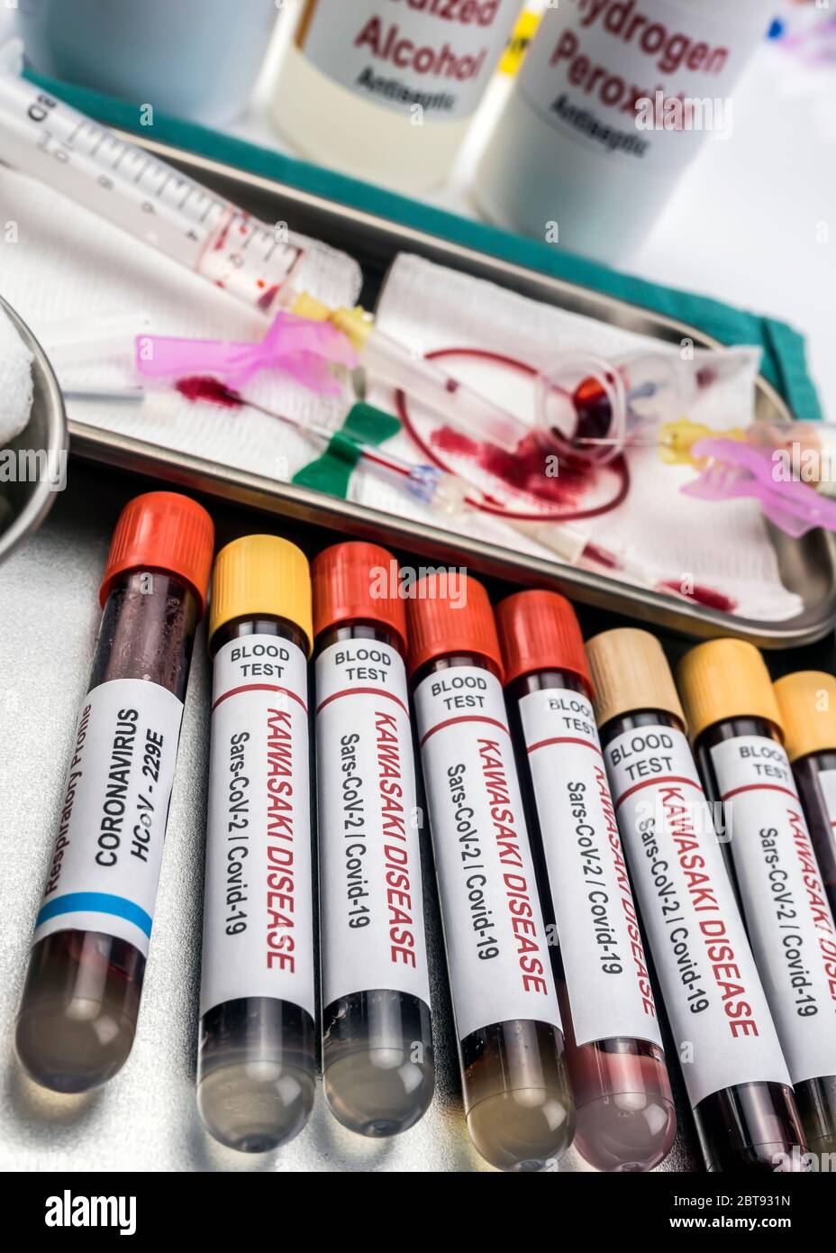 Blood samples to treat Sars-CoV-2-related Kawasaki disease in children ...