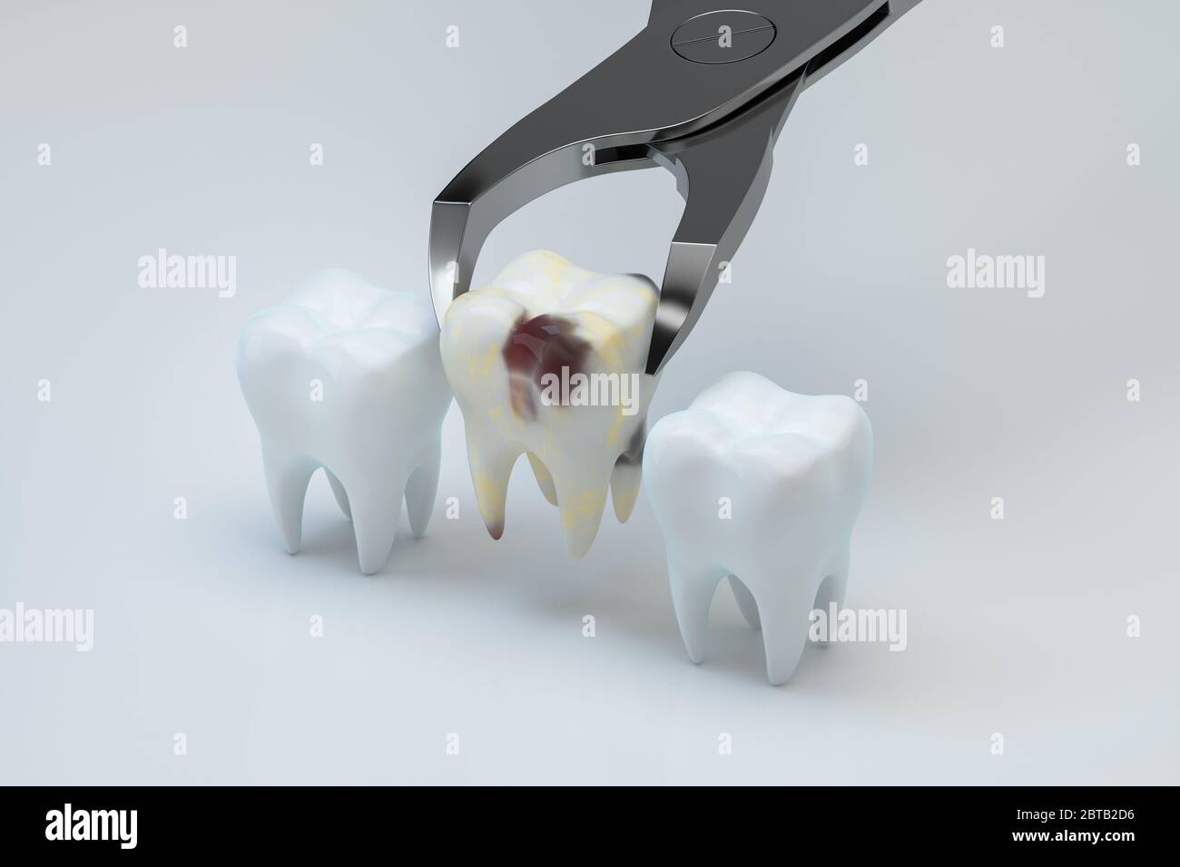 The sick tooth being pulled out, 3d rendering. Computer digital drawing ...