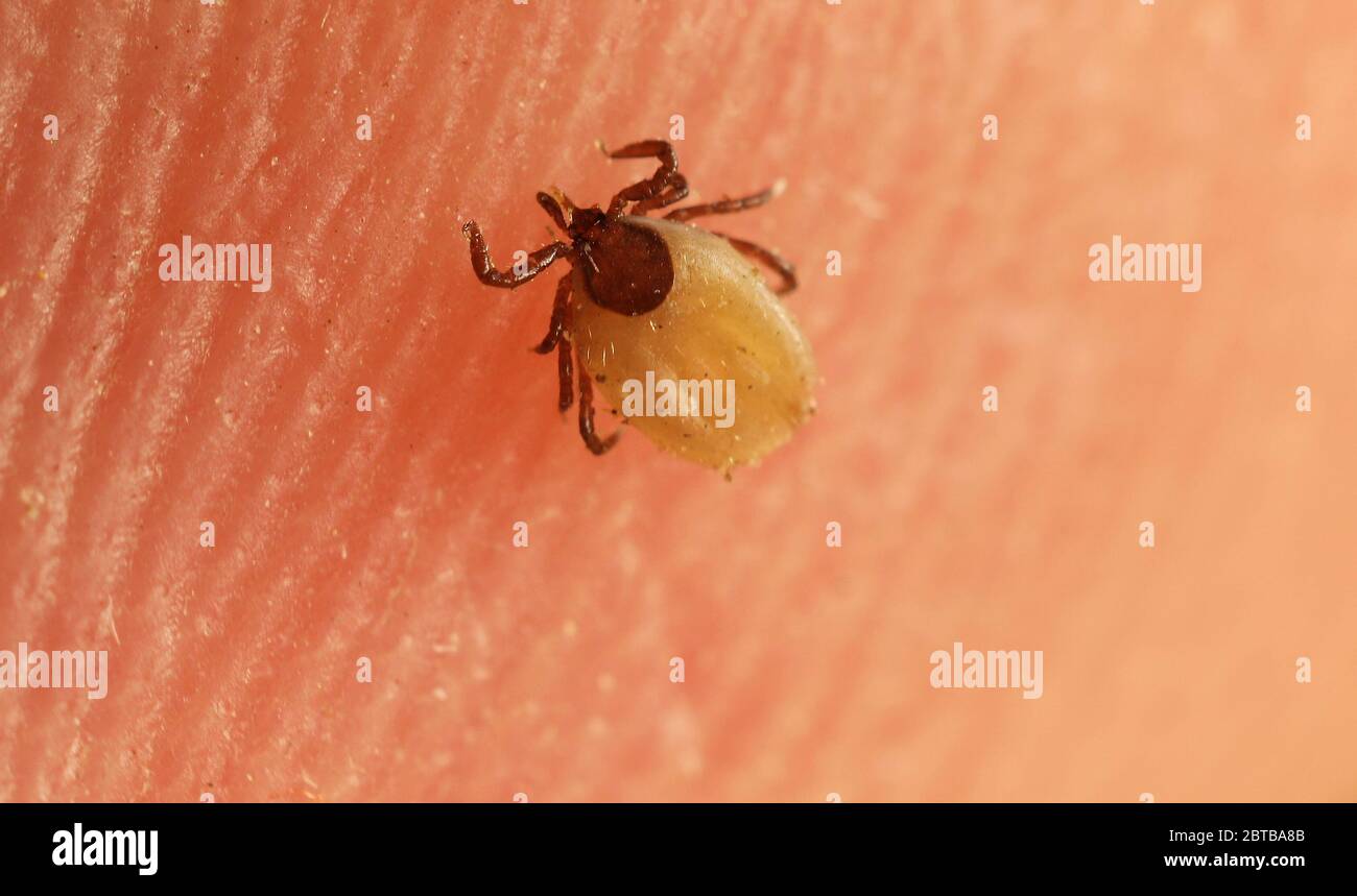 Tick on skin Stock Photo - Alamy