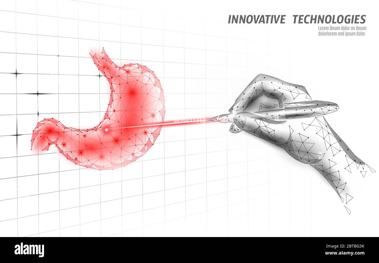 Abdomen laser Stock Vector Images - Alamy