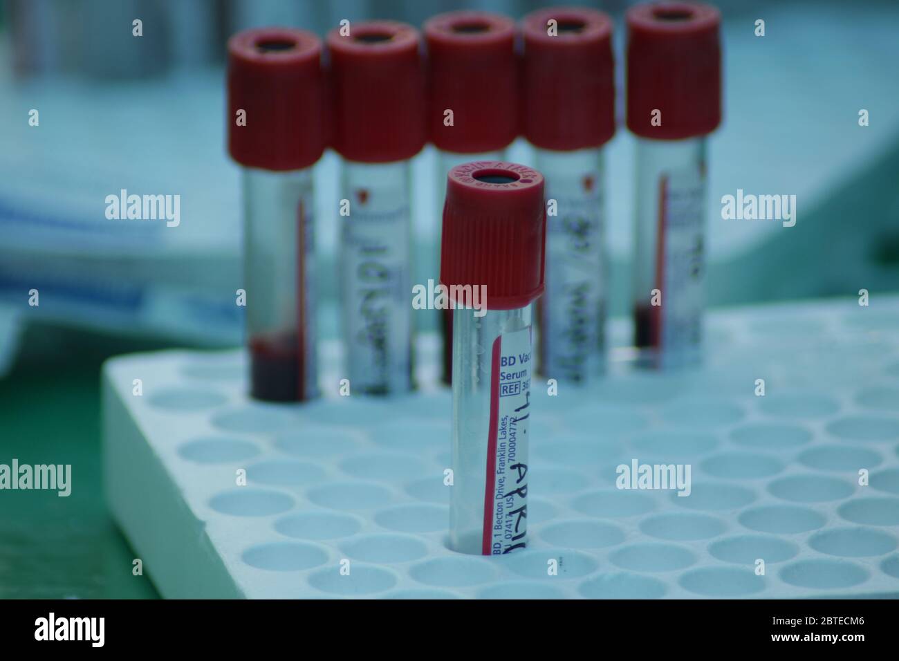 Blood sample in a laboratory tube Stock Photo - Alamy