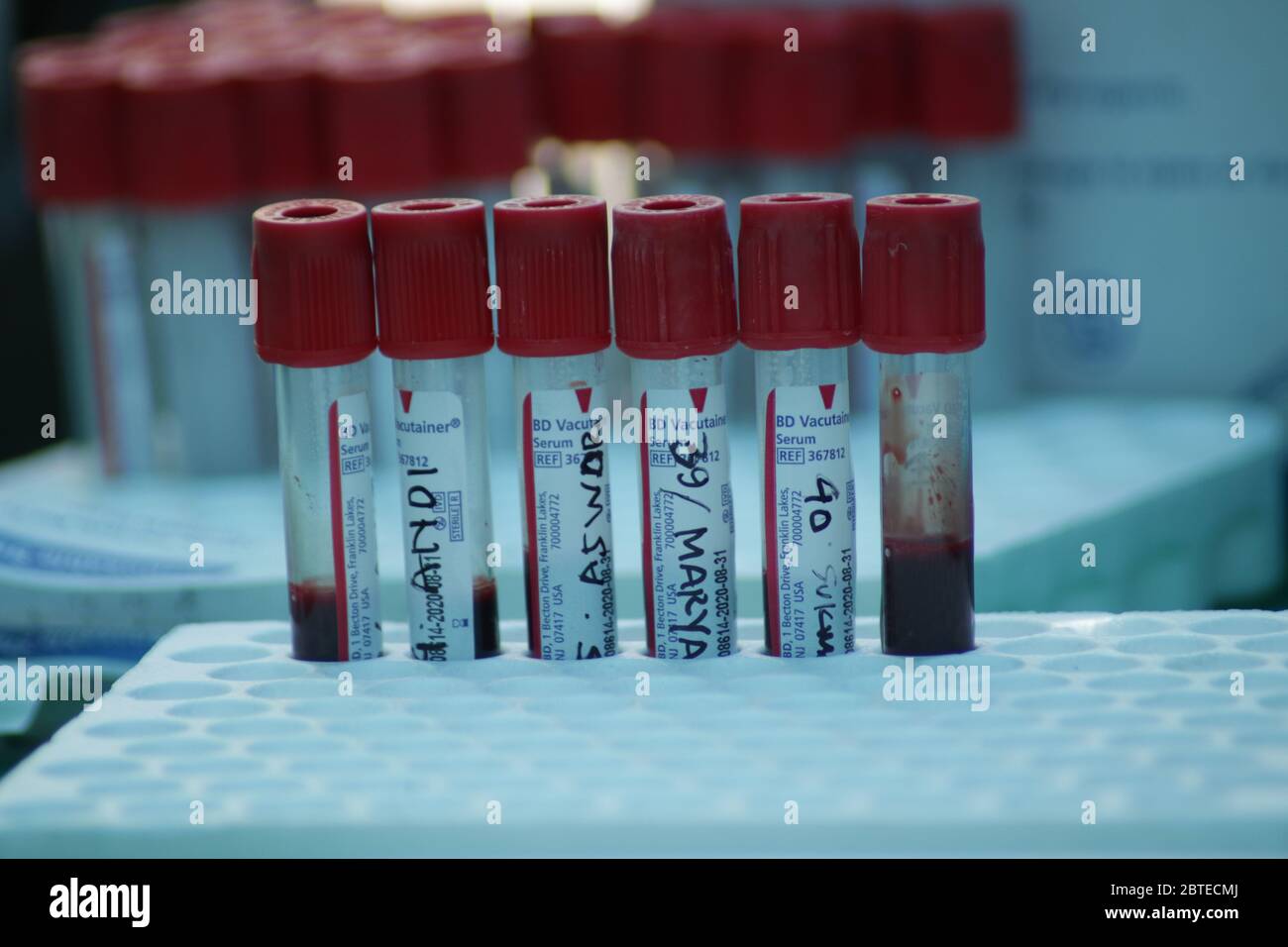 Blood sample in a laboratory tube Stock Photo - Alamy