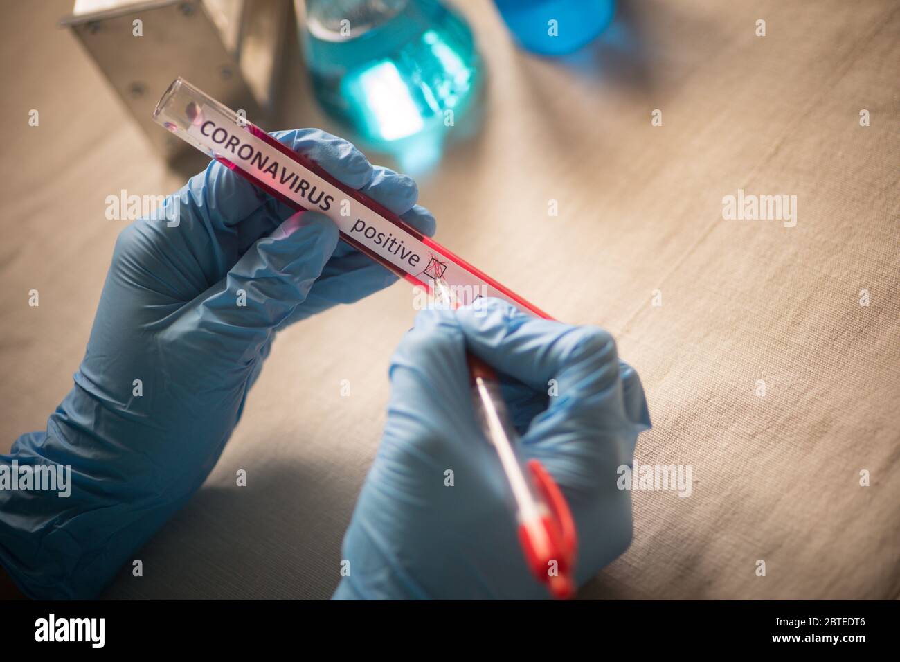 Conceptual photograph of a doctor's hands holding and marking a test ...