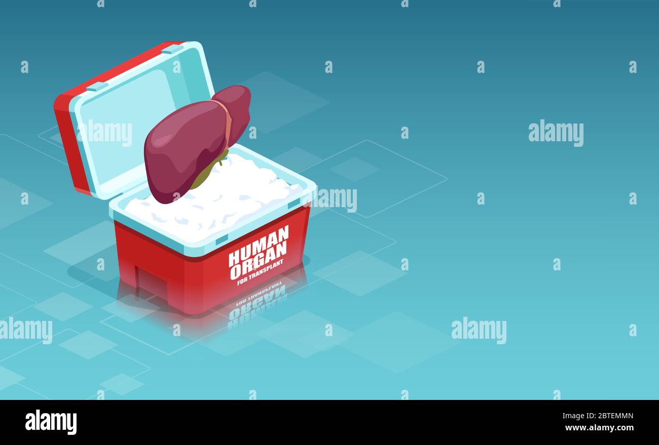 Organ transplant hi-res stock photography and images - Alamy