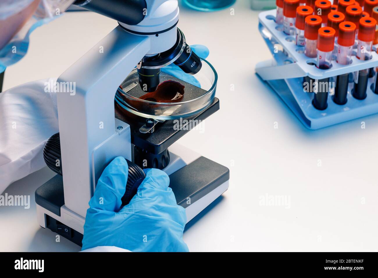 Hands of a laboratory worker doing blood test Stock Photo - Alamy