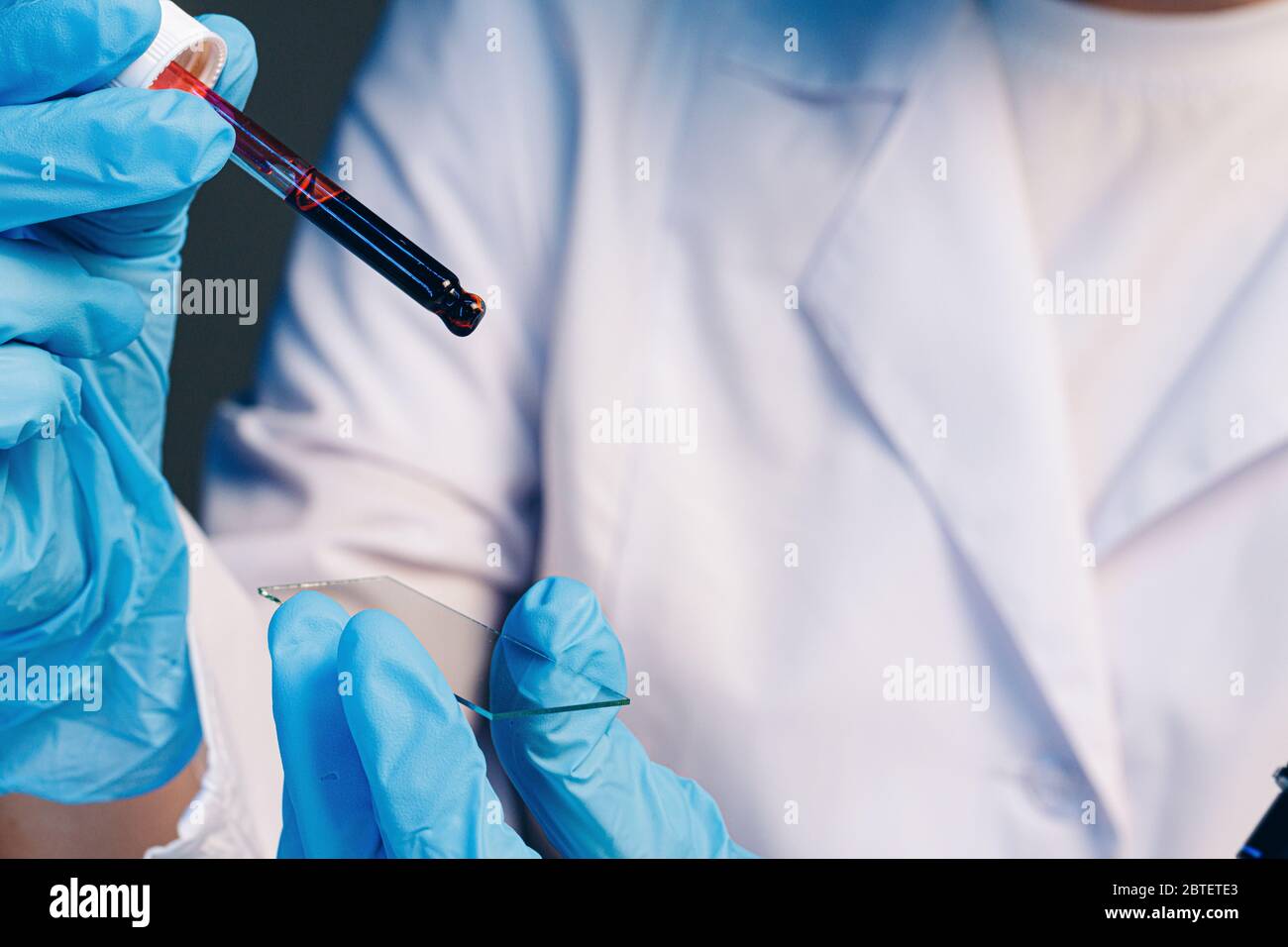 Hands of a laboratory worker doing blood test Stock Photo - Alamy