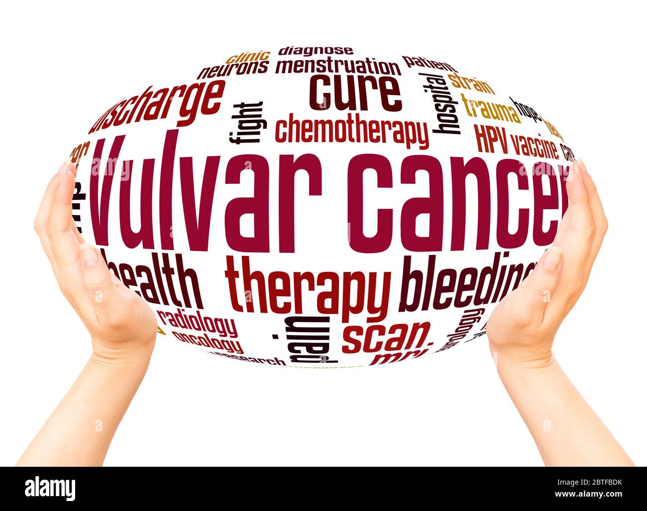 Vulvar cancer word hand sphere cloud concept on white background Stock ...