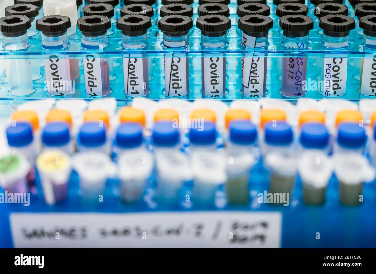 Vials with samples of SARS-COV-2 Covid-19 in a research laboratory ...