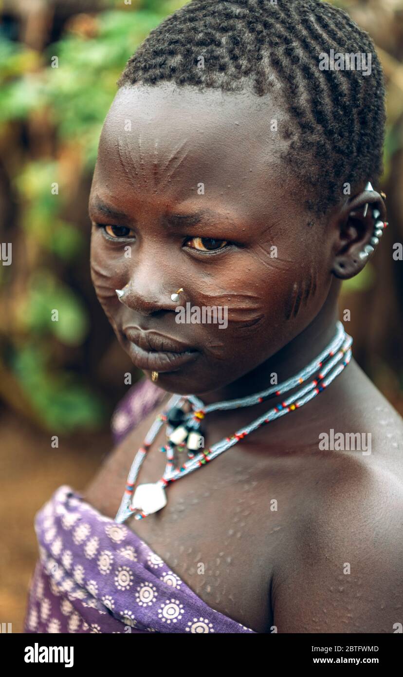 Girl with scar hi-res stock photography and images - Alamy
