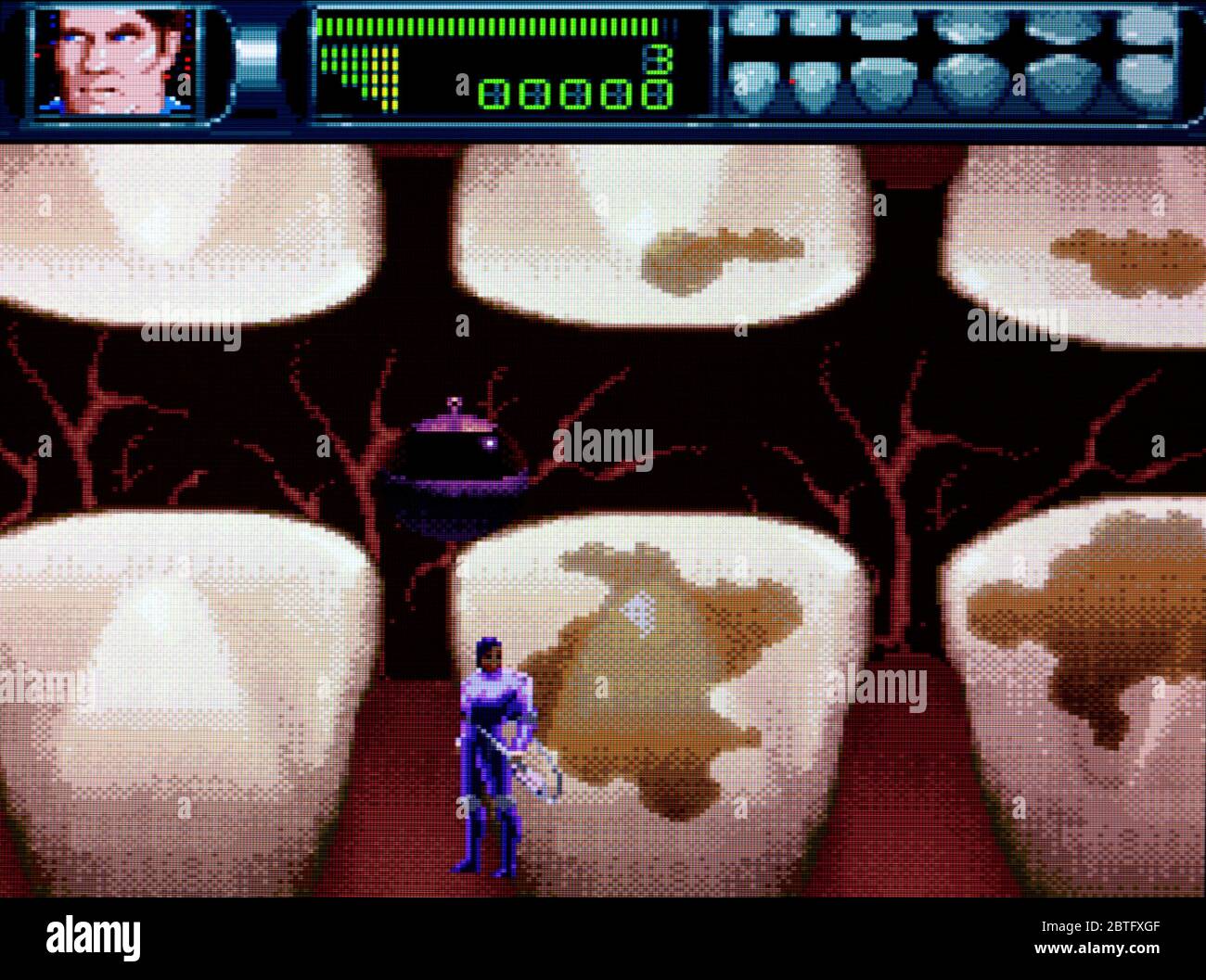 Rex Ronan Experimental Surgeon - SNES Super Nintendo - Editorial use ...