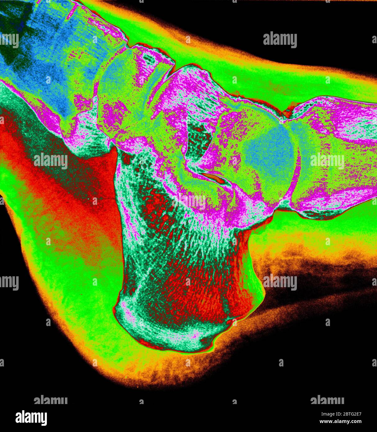 Coloured x-ray, ankle Stock Photo - Alamy