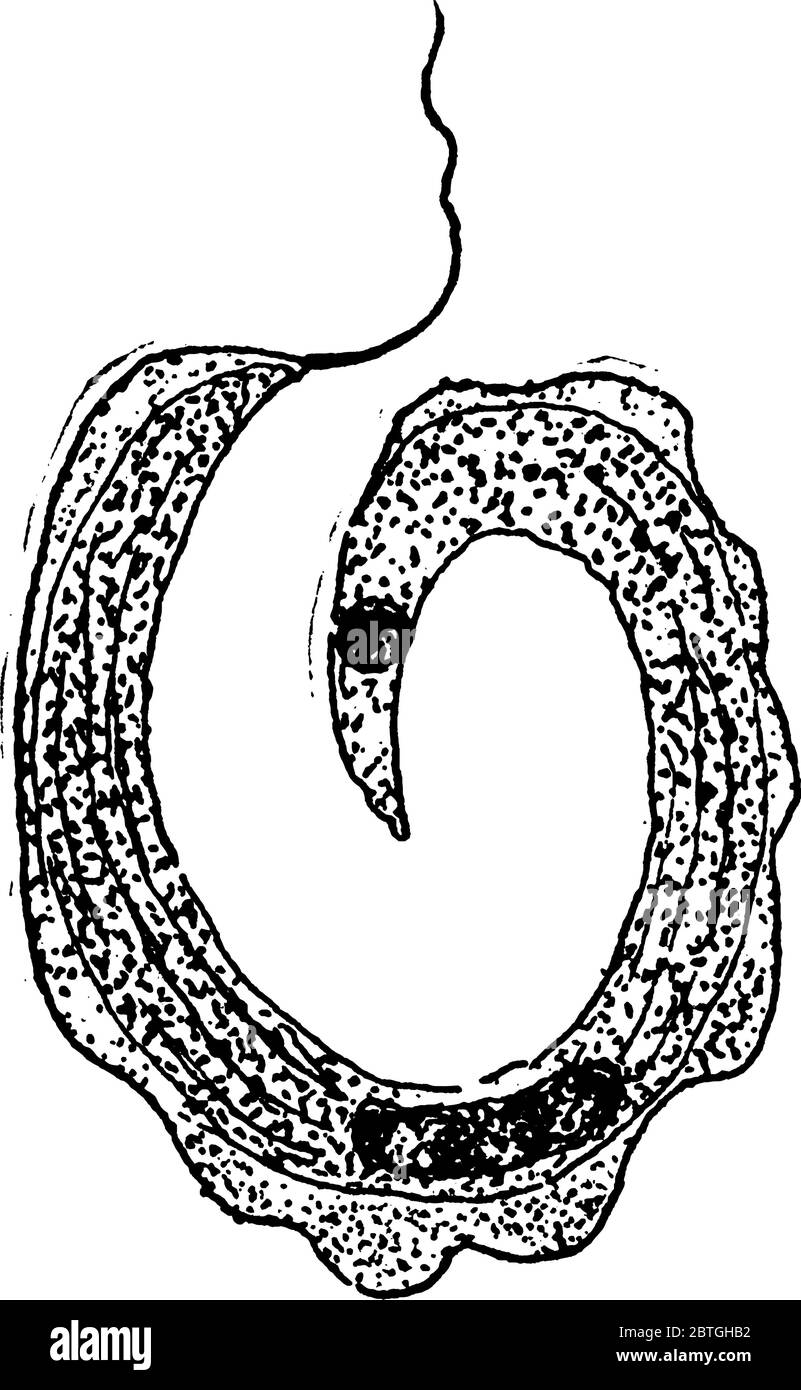 figure shows trypanosomes, which are unicellular parasitic protozoa ...