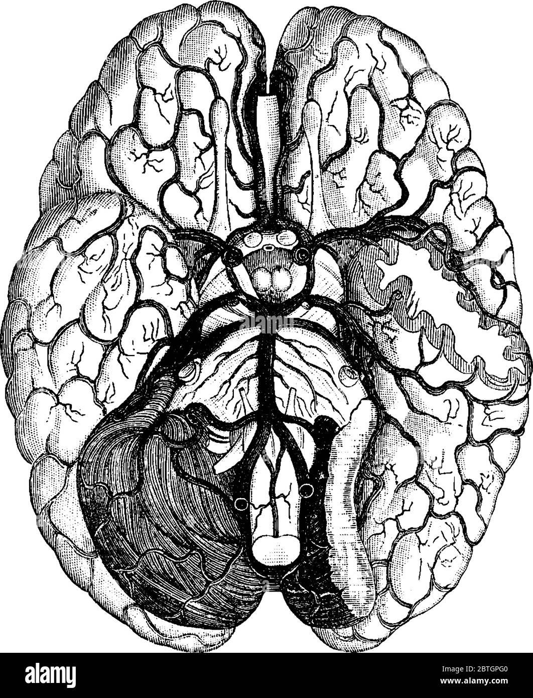 Arteries brain Black and White Stock Photos & Images - Alamy