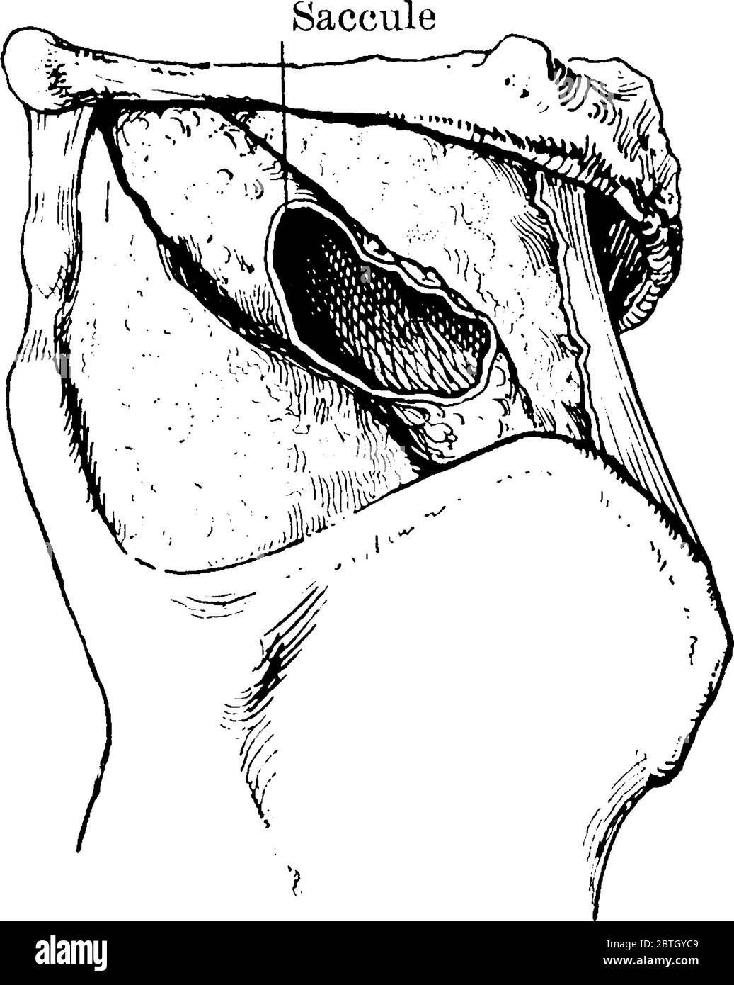 The specimen showing a greater extension of the saccule of the larynx ...