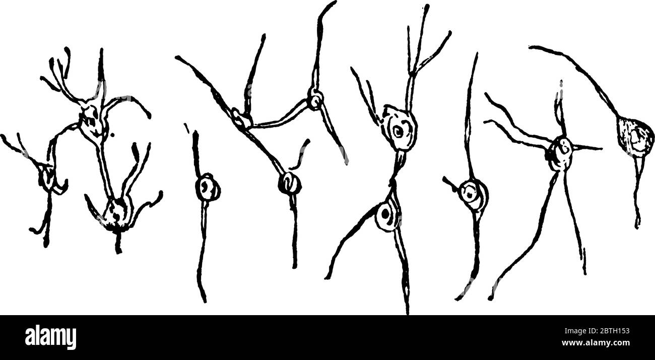 Forms of nerve-cells, also called as neurons, basic units of nervous ...