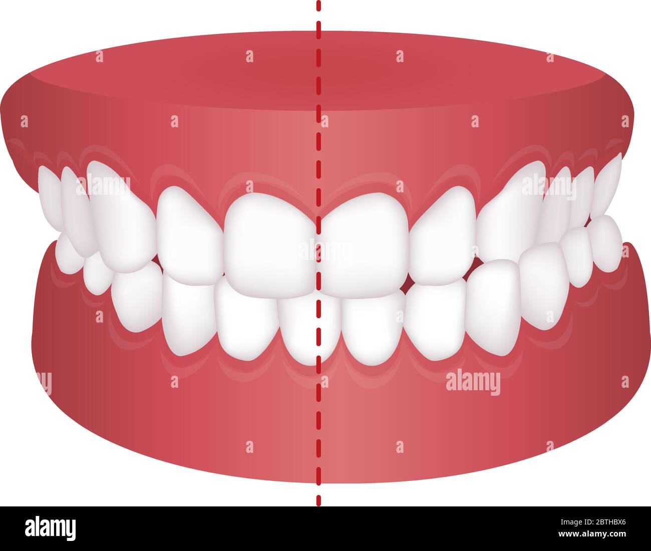 Dental misalignment Stock Vector Images - Alamy