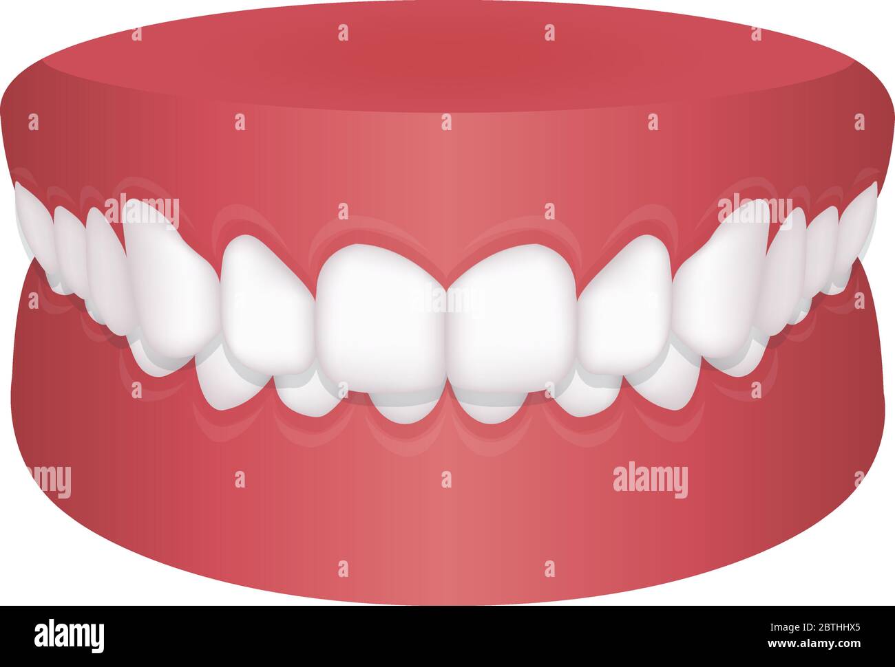 Teeth trouble ( bite type ) vector illustration /Deep bite Stock Vector ...