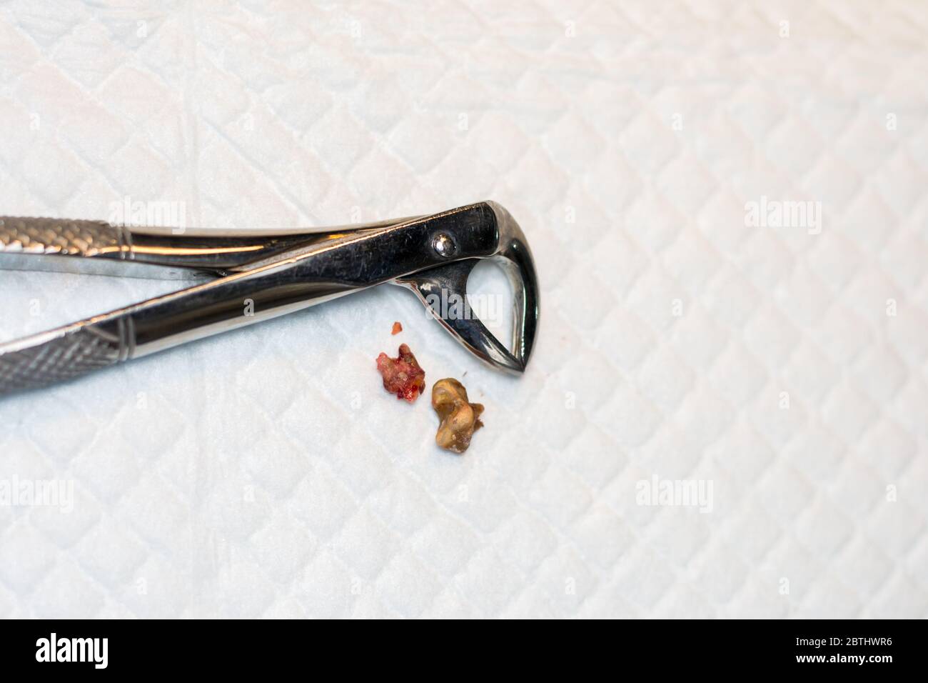 extracted dog teeth and extraction pliers close-up Stock Photo - Alamy