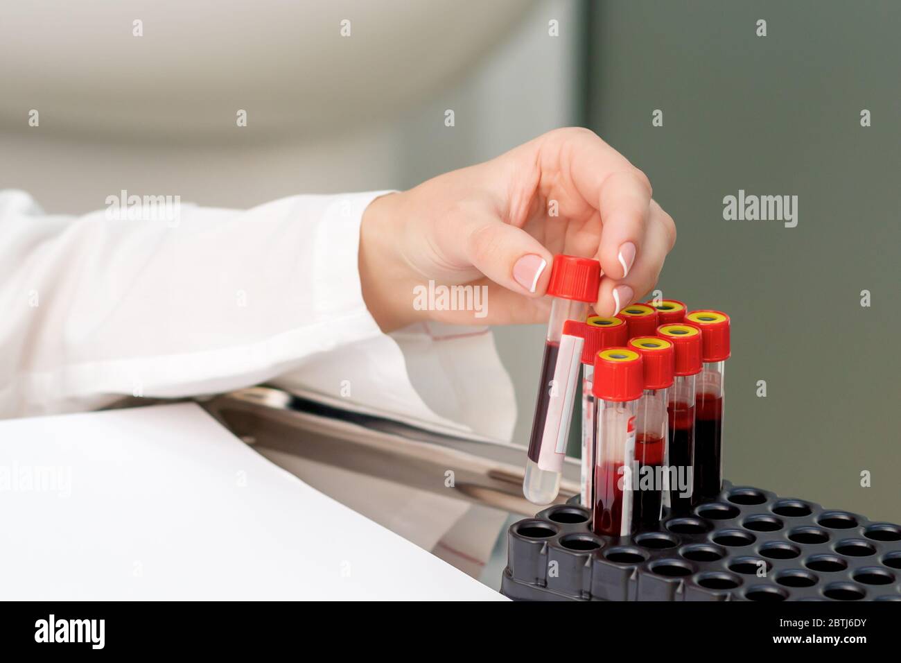 Hand of doctor is taking test tube with blood from tray on table in the ...