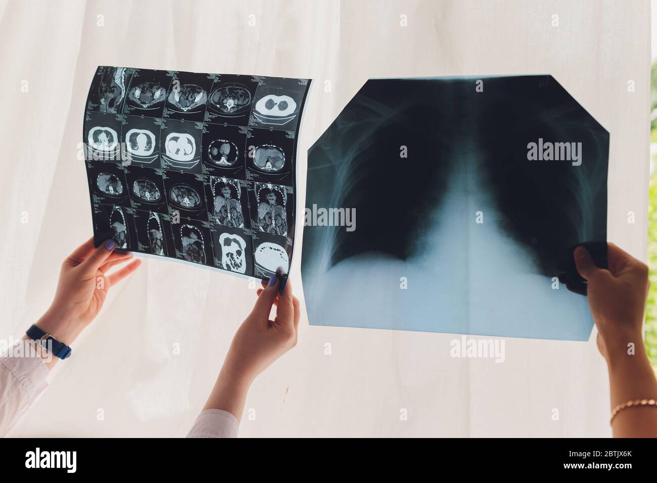 X ray light box hi-res stock photography and images - Alamy