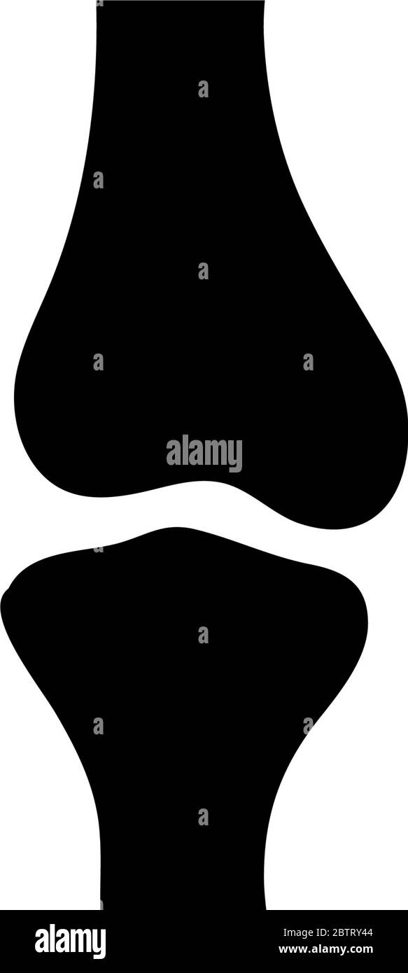 Knee Joint, Human Bone, Articular Cartilage. Flat Vector Icon ...