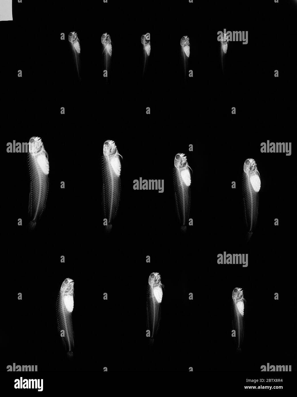 Edentulus hi-res stock photography and images - Alamy